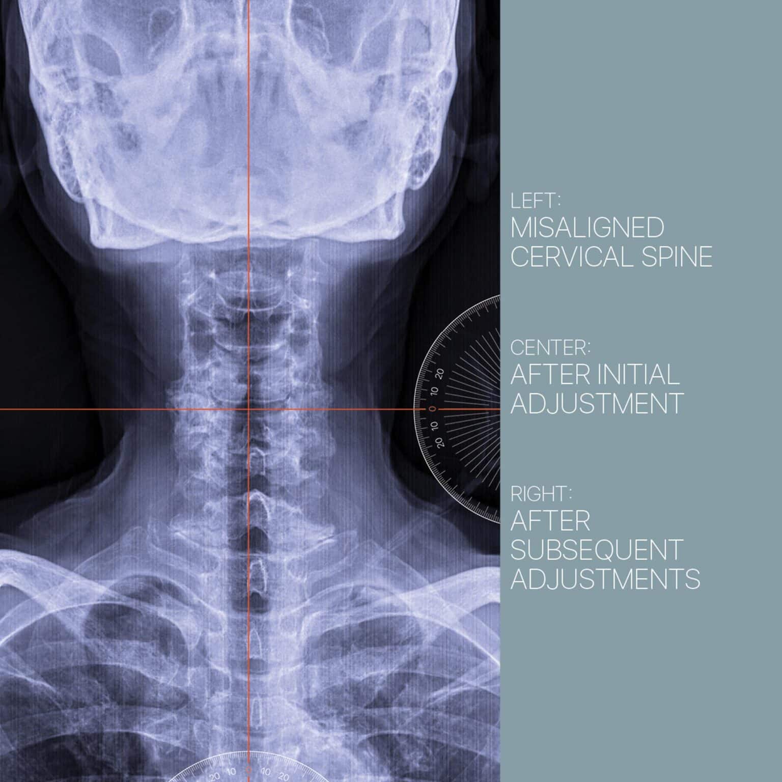 Misalignment Artwork » educare.design
